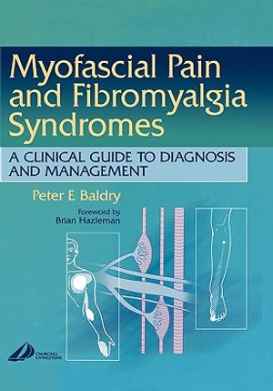 Myofascial Pain and Fibromyalgia Syndromes: A Clinical Guide to ...