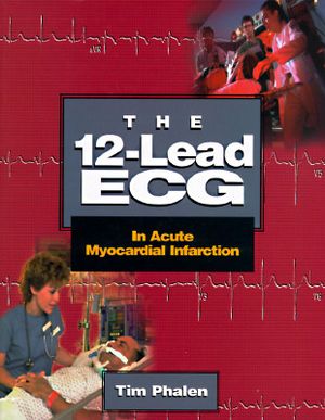 The 12-Lead ECG in Acute Myocardial Infarction