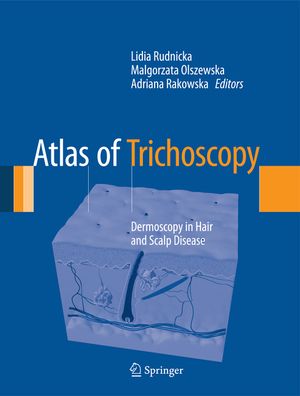 Atlas of Trichoscopy: Dermoscopy in Hair and Scalp Disease | 9781447144854