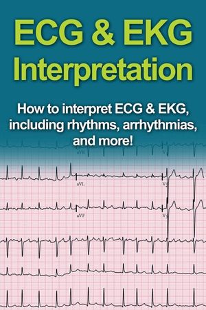 ECG & EKG Interpretation: How to interpret ECG & EKG, including rhythms ...