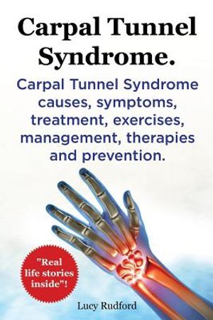 Carpal Tunnel Syndrome, Cts. Carpal Tunnel Syndrome Cts Causes ...