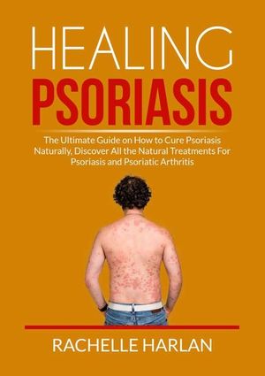 Healing Psoriasis: The Ultimate Guide on How to Cure Psoriasis Naturally, Discover All the ...